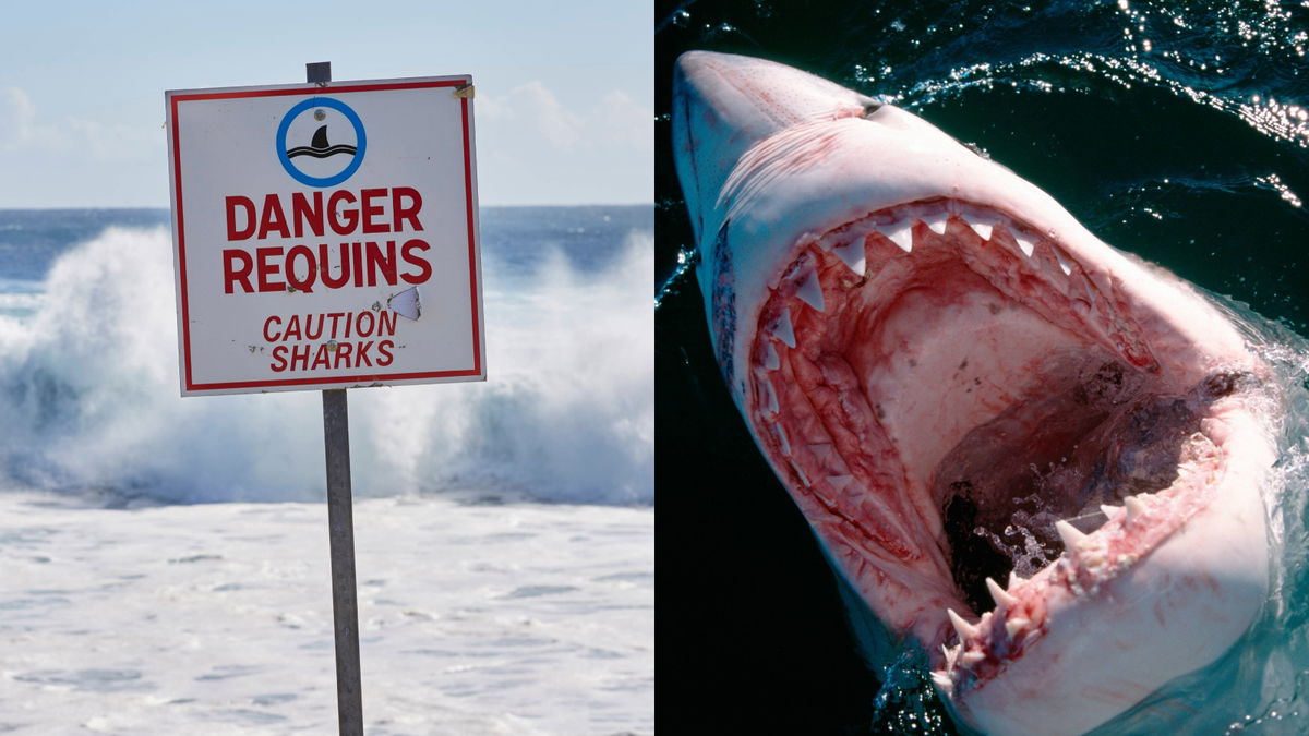 Hours After Getting Bitten by a Shark, 30-Year-Old Pro Surfer Suffers ...