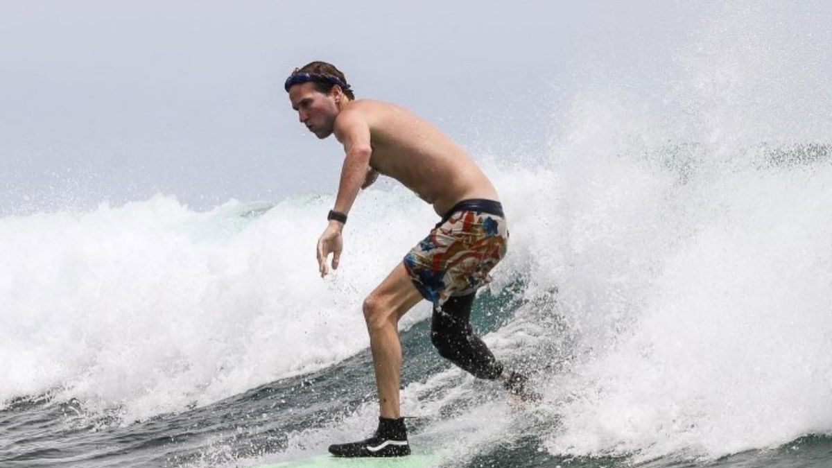 “I’m Blown Away by Your Footage”: Despite Losing Lung and Leg From Rare ...