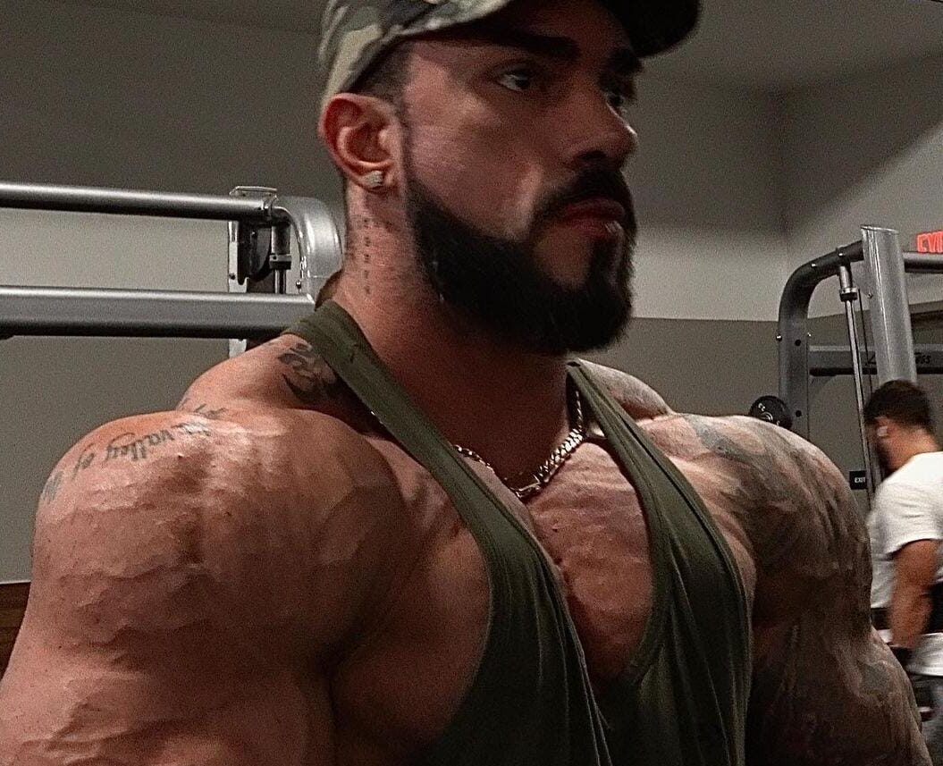 Cuban IFBB Pro Who Recently Underwent Open Heart Surgery Finally ...