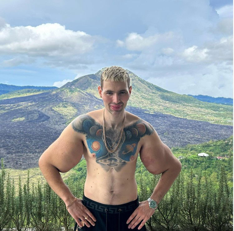 “I’m Surprised He’s Not Dead Tbh”: Risking Amputation, Former MMA ...