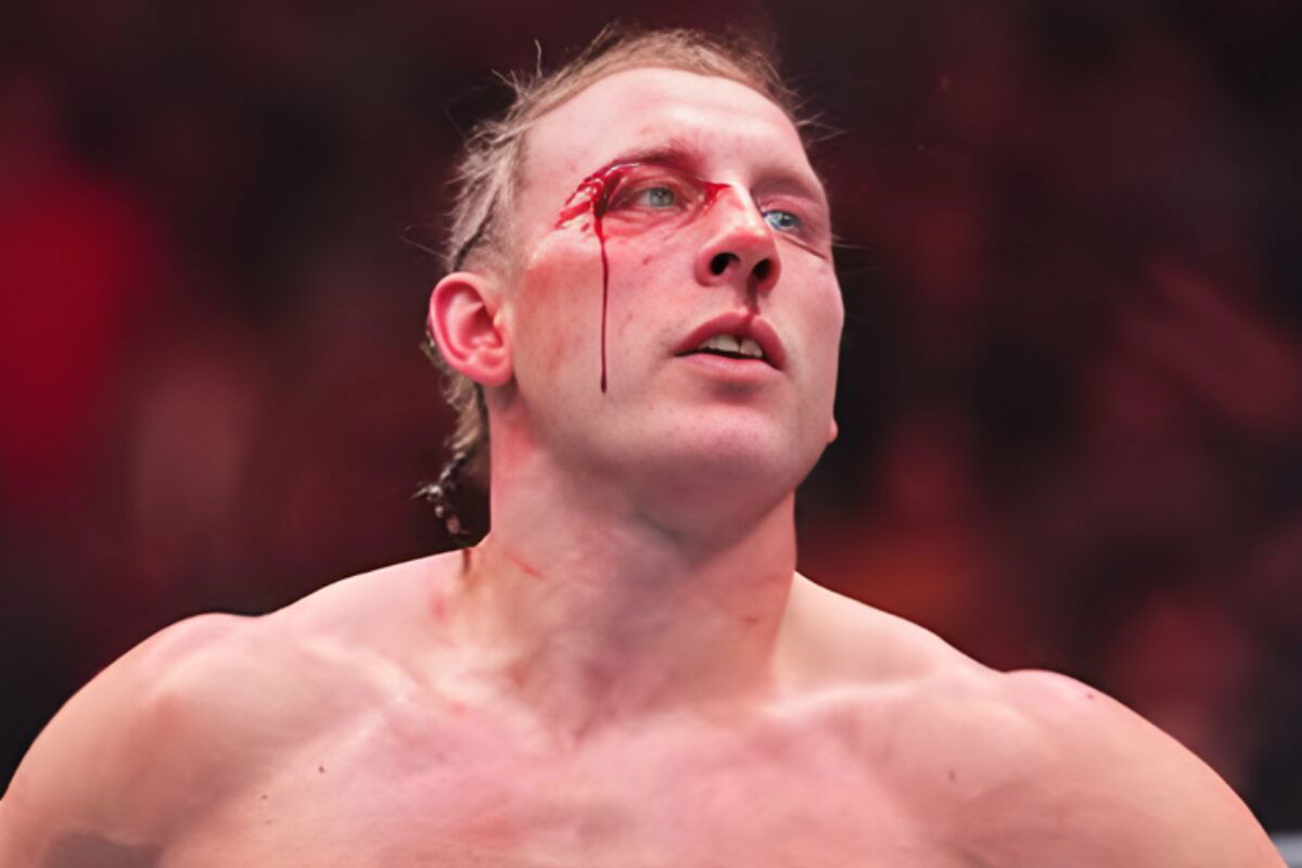 Dana White Shares Update On Hospitalized Paddy Pimblett After UFC 324 ...