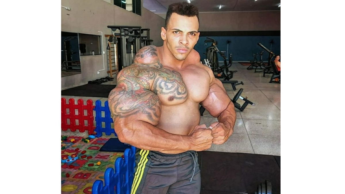 Eager to Look Like “Incredible Hulk,” 25-Year-Old Bodybuilder Nearly ...