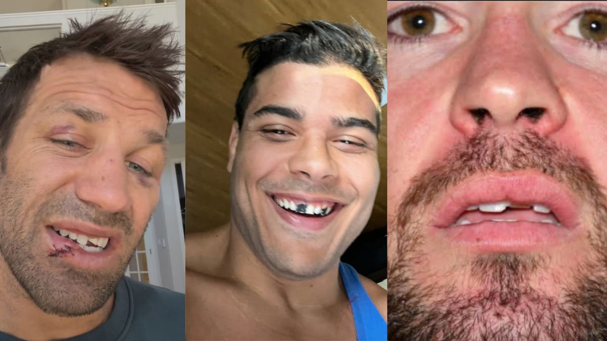 “Toothless Gang” – Paulo Costa’s Disrespectful Jibe at Luke Rockhold ...