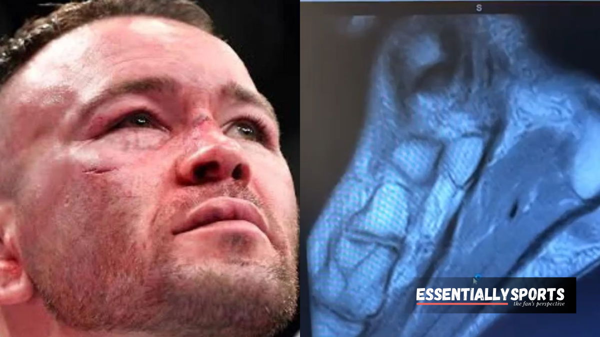 X-Ray Evidence Reveals Broken Mangled Foot as Colby Covington Confirms ...