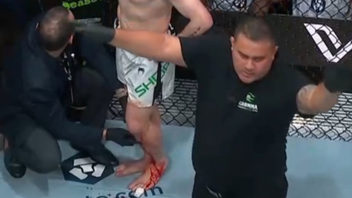 UFC Injury: “Joe Rogan's Fight of the Year” – Questionable Doctor ...