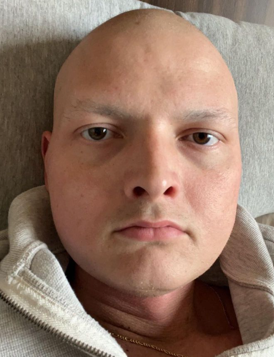 Paralyzed by Cancer, 220 Lbs Bodybuilder Ditched Death To Give Himself ...