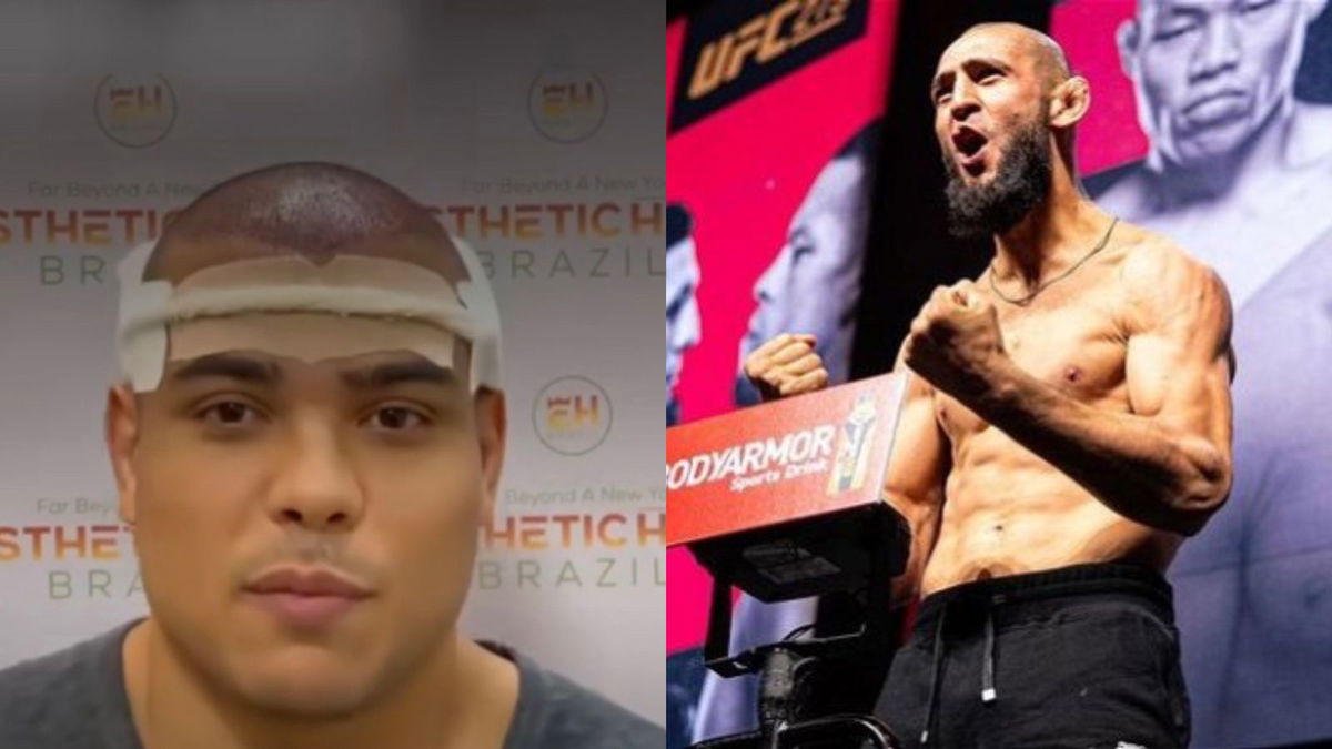 “As a Bald Man I Know Just How P*ssed Paulo Is When He Sees This ...