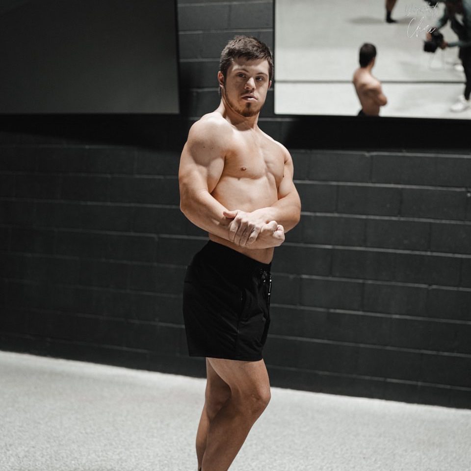 Bodybuilding Enigma With Down Syndrome Follows Arnold Schwarzenegger’s ...
